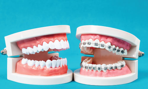Services | Shepparton Denture Clinic